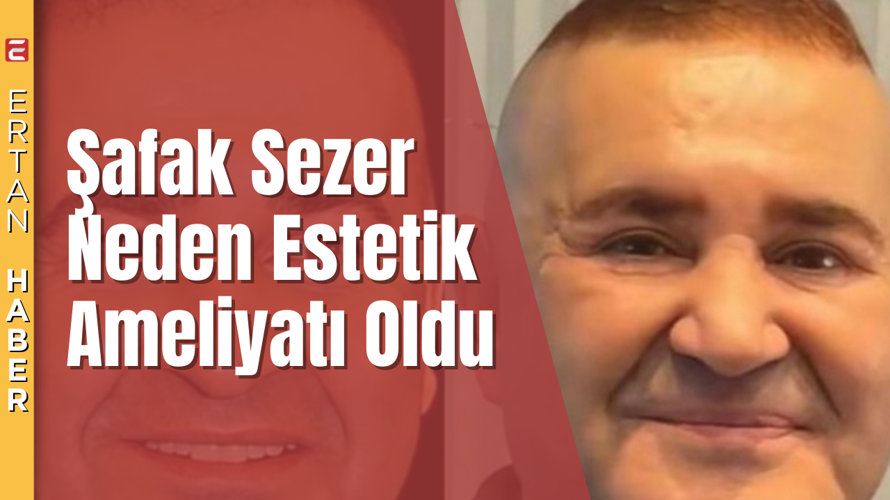 Şafak Sezer Neden Estetik Yaptırdı?